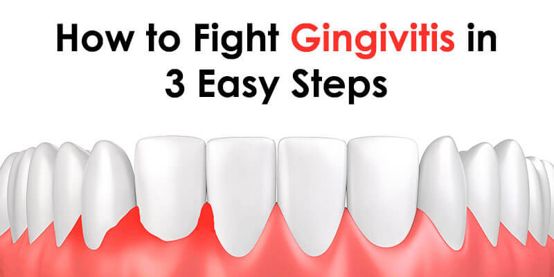 How to Fight Gingivitis in 3 Easy Steps - Shanti Dentals